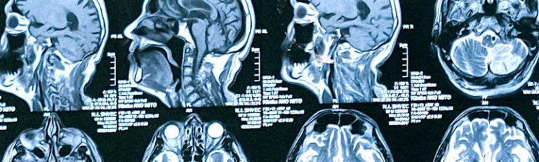Position Openings in the Brain Stimulation Lab | Biomedical Engineering ...