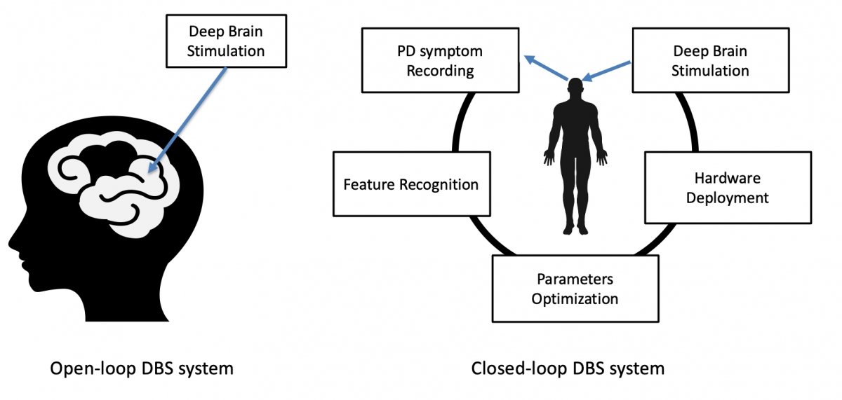 Michigan Tech Researchers Develop ‘Smart’ Deep Brain Stimulation ...
